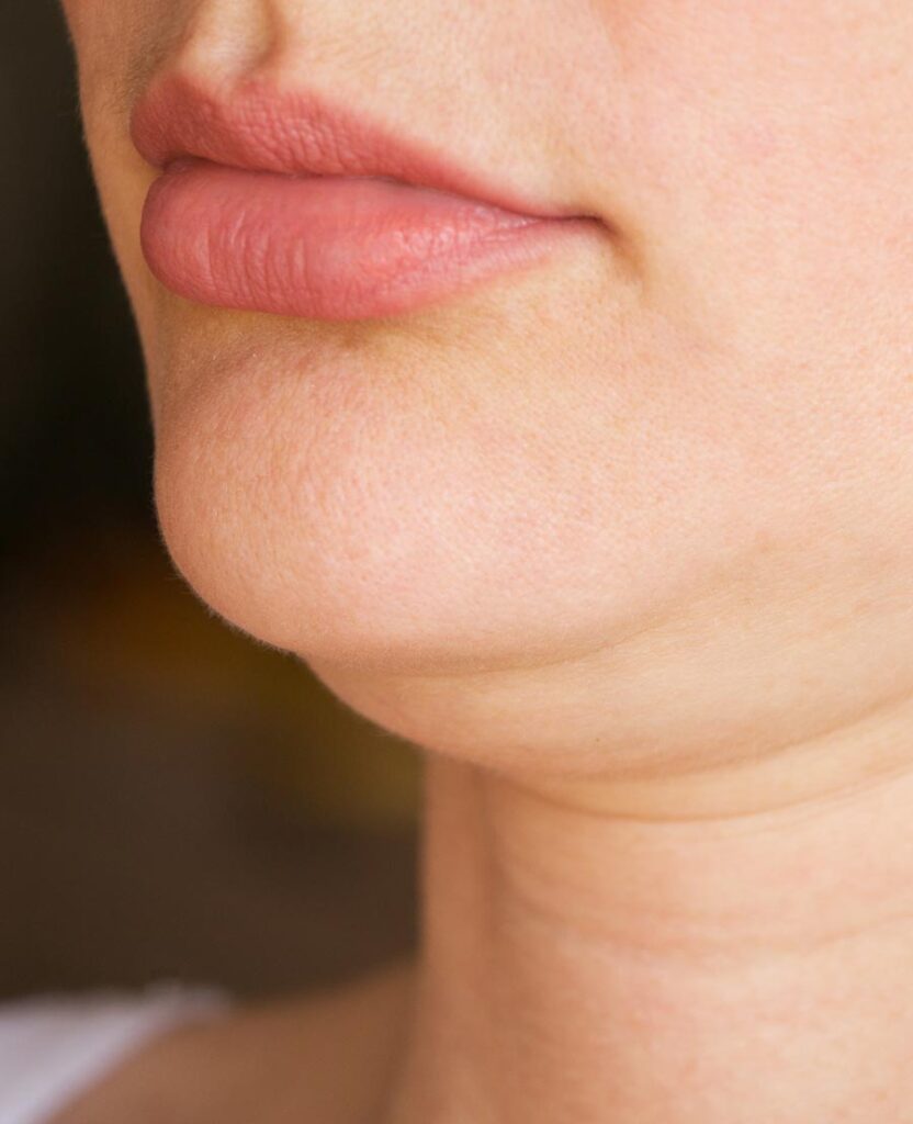 Brow Ptosis and Droopy Eyebrow Treatments at Face Restoration