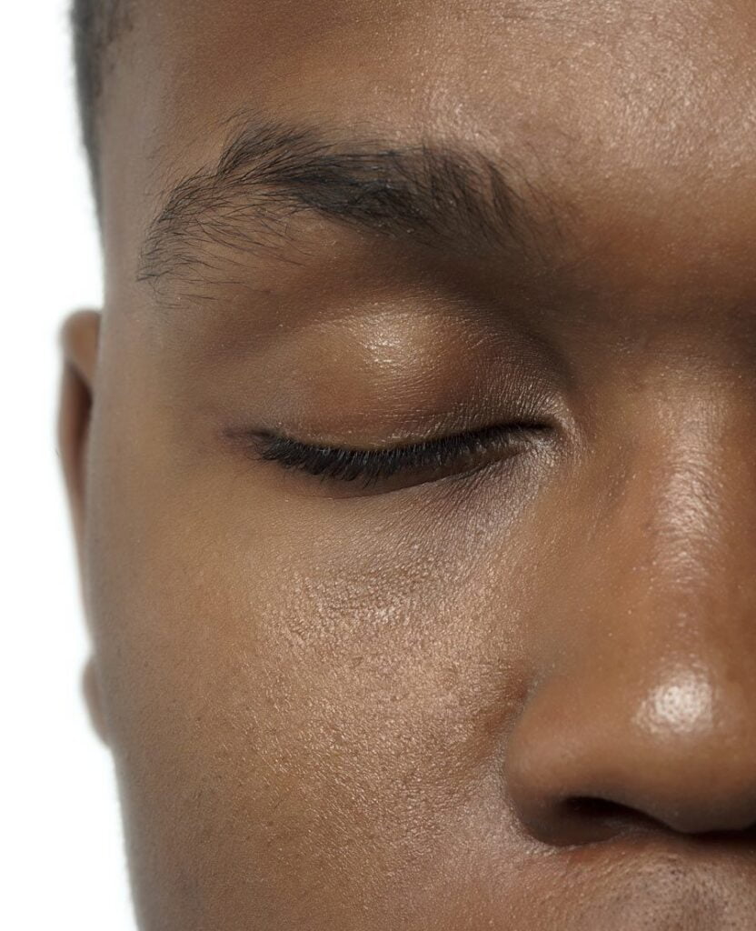 Brow Ptosis and Droopy Eyebrow Treatments at Face Restoration