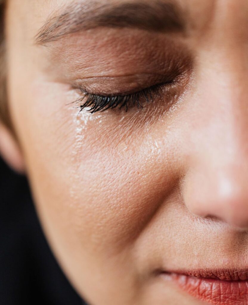 Wet & Watery Eye Conditions & Streaming Eye Symptoms | Epiphora