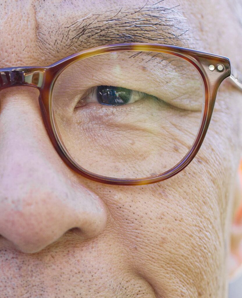 Eyelash epilation & excision - Face Restoration Facial Aesthetics