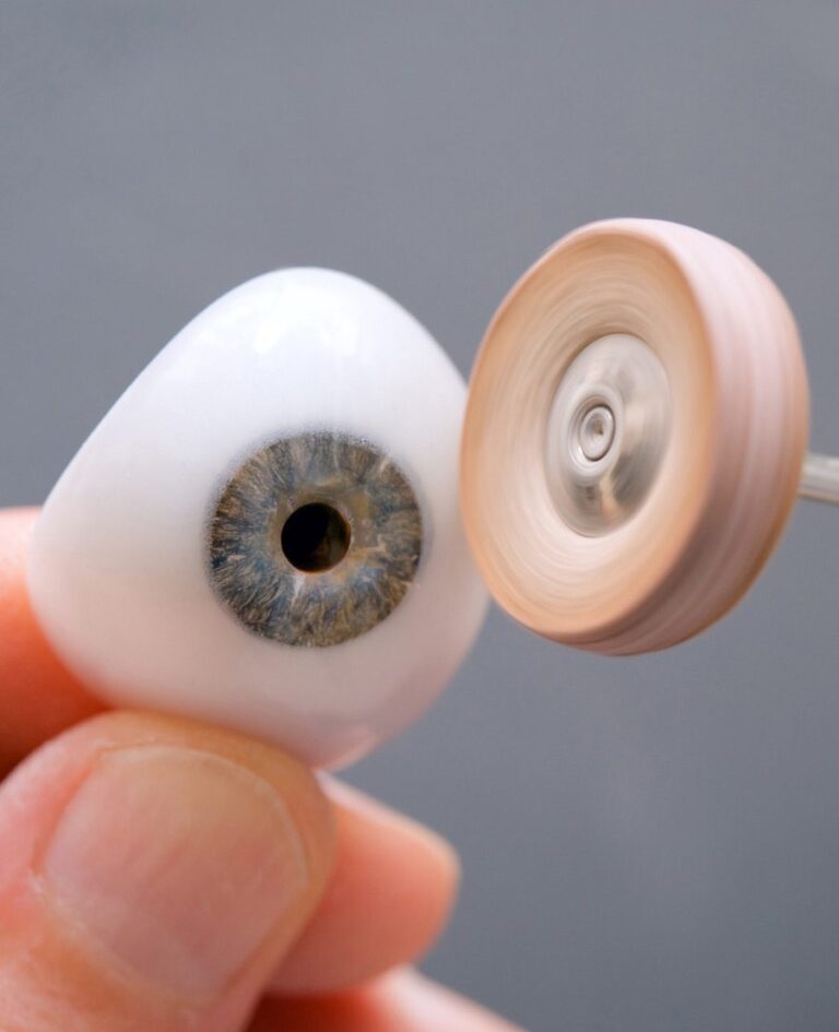 Ocular Prosthetics | Customised Solution for Natural Looking Eyes