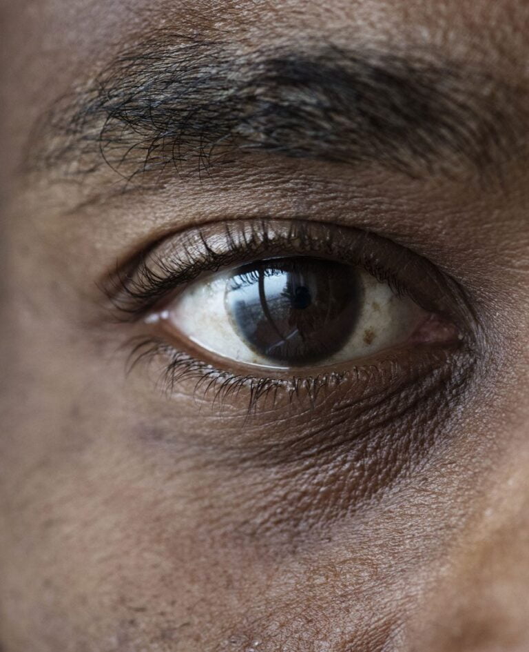 Socket Revision Surgery and Expert Eye Care | Face Restoration